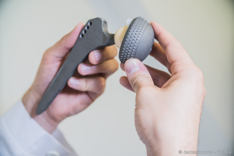 Coxarthrose (Hüftarthrose): Ursachen, Therapie, Vorbeugen - NetDoktor