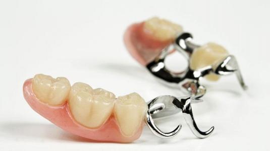 Teleskopprothese: Alles wichtige zur Zahnprothese - NetDoktor.de